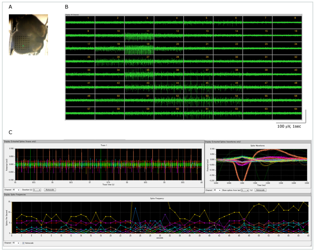 Single Unit Activities From Spinal Cord Slices - med64.com